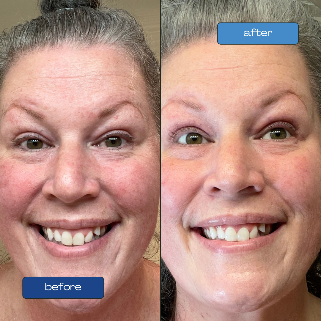 Methylene Blue Anti-Aging Skincare Testimonials - Bluelene Creams