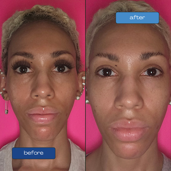 Methylene Blue Anti-Aging Skincare Testimonials - Bluelene Creams