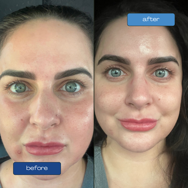 Methylene Blue Anti-Aging Skincare Testimonials - Bluelene Creams